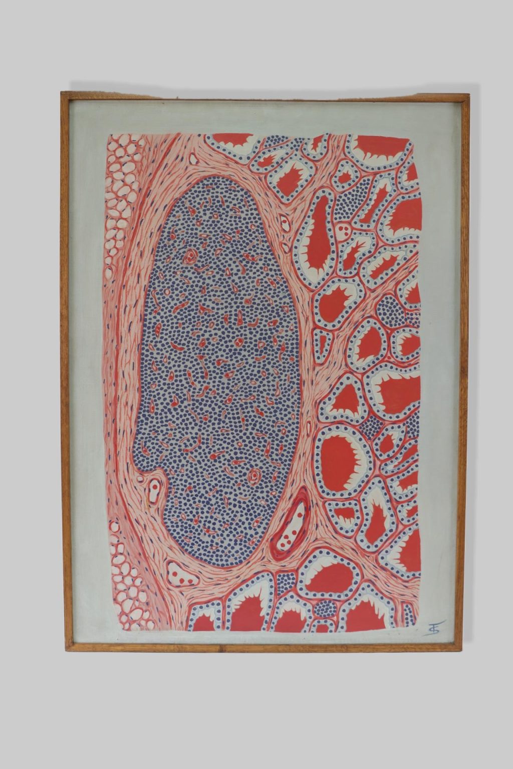 Paratiroidna žlijezda (epitelno tjelešce) / parathyroid gland (glandula ...