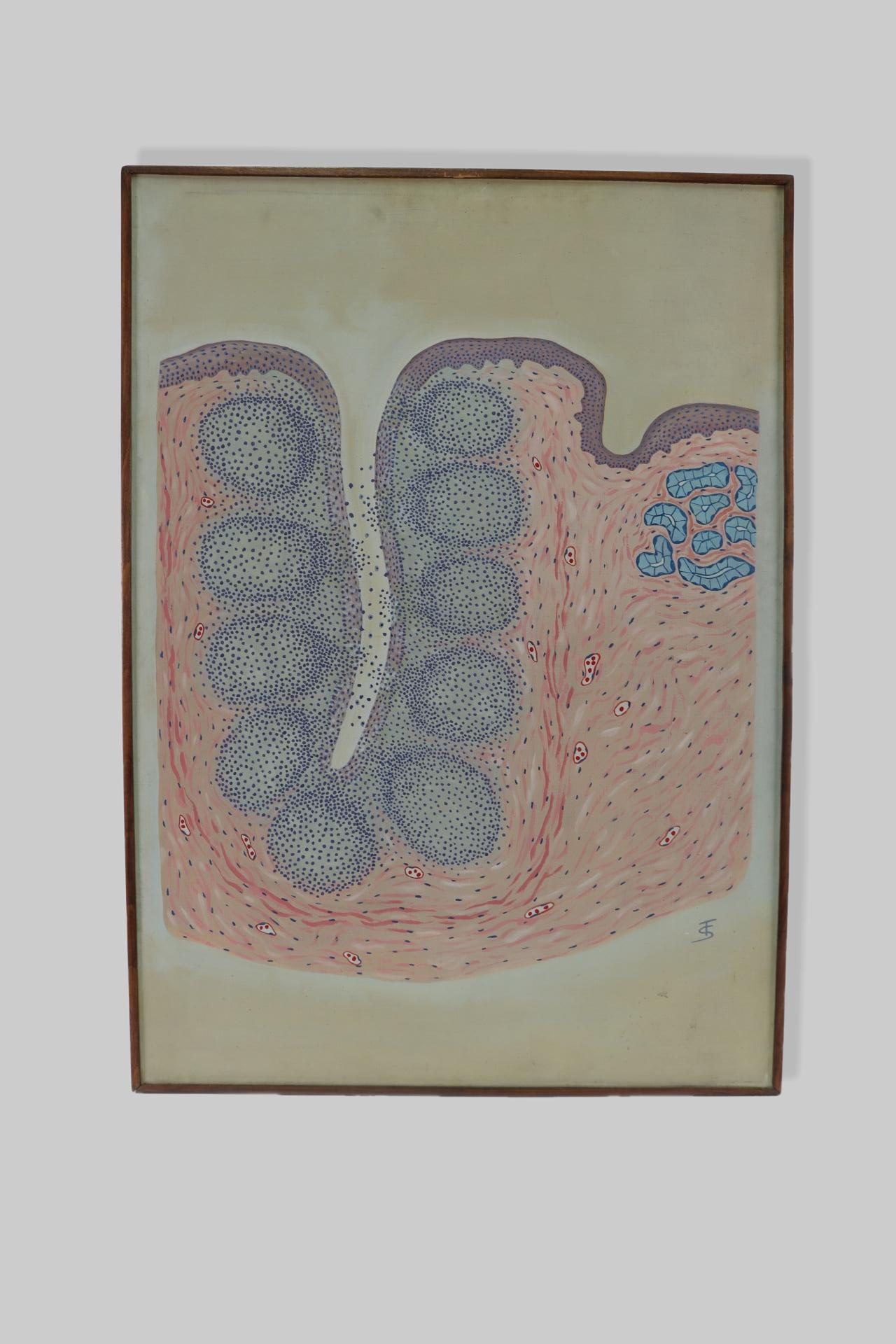 Tonzila / tonsil (tonsilla) - VEF EXPO